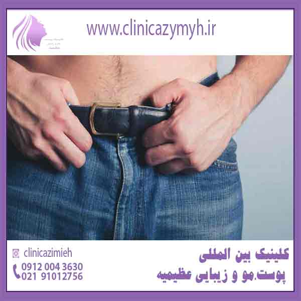 روش های بزرگ کردن آلت تناسلی کلینیک بین المللی پوست و مو زیبایی عظیمیه